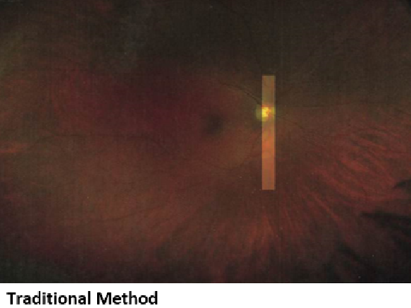 Crystal PM Patient Forms