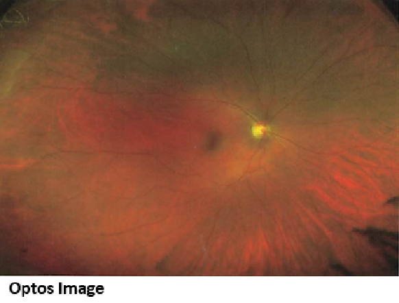 Crystal PM Patient Forms